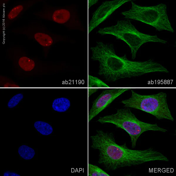 Anti-SCG10 antibody (ab21190) | Abcam