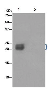 Anti-SCG10 antibody [EPR15286-39] - BSA and Azide free (ab250859) | Abcam