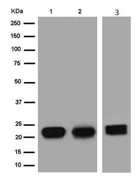 Anti-SCG10 antibody [EPR15286-39] - BSA and Azide free (ab250859) | Abcam