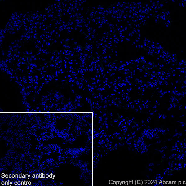 Anti-SCN11A antibody [EPR28603-66] (ab316324) | Abcam