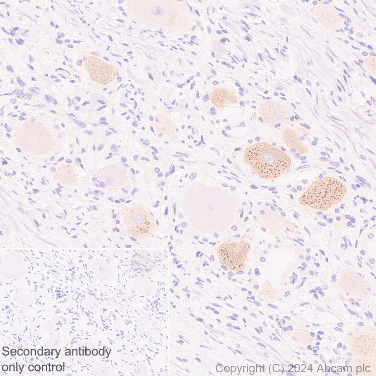 Anti-SCN11A antibody [EPR28603-86] (ab316326) | Abcam
