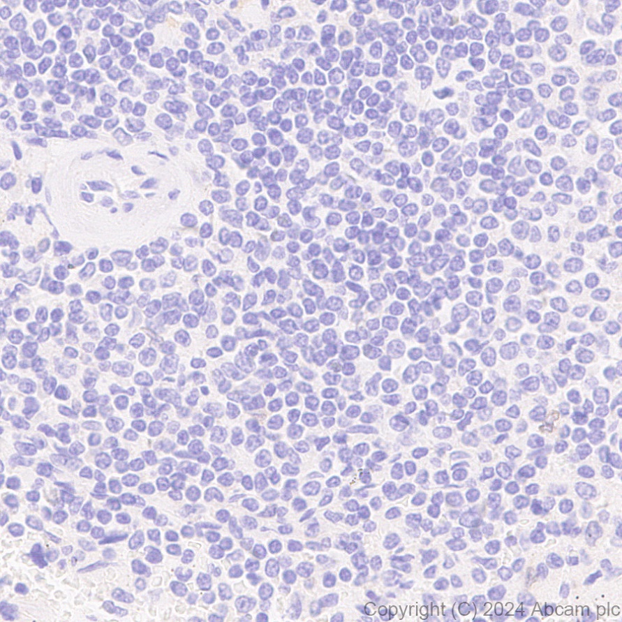 Anti-SCN11A antibody [EPR28603-86] - BSA and Azide free (ab316327) | Abcam