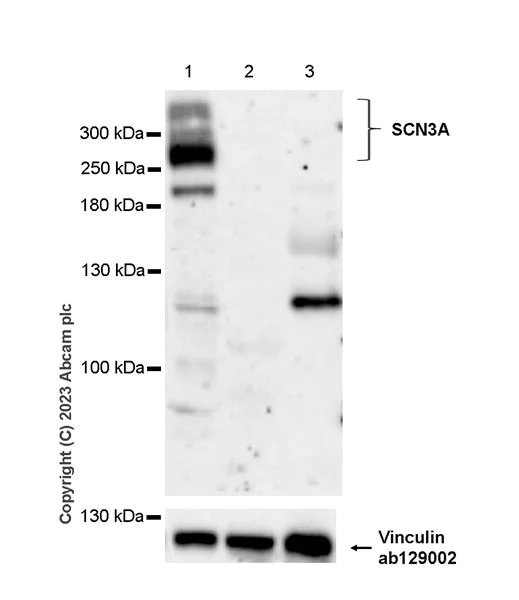 Anti-SCN3A antibody [EPR25135-66] - BSA and Azide free (ab309474) | Abcam