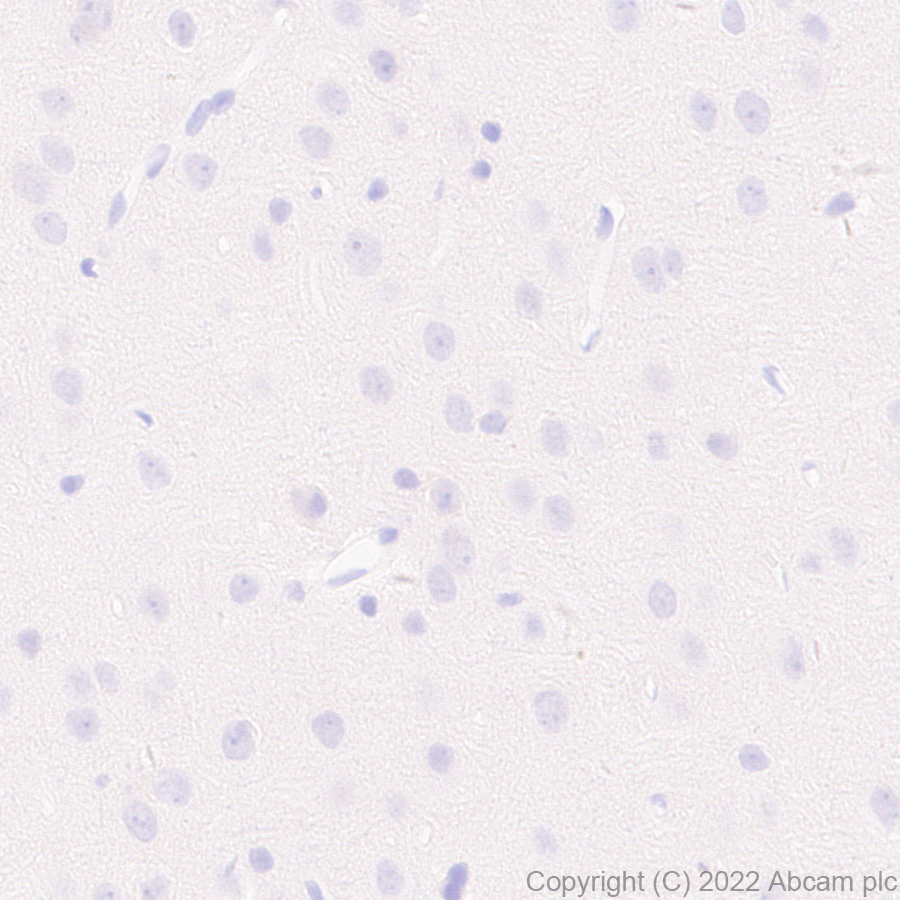 Anti-SCXA antibody [EPR26997-33] (ab307722) | Abcam