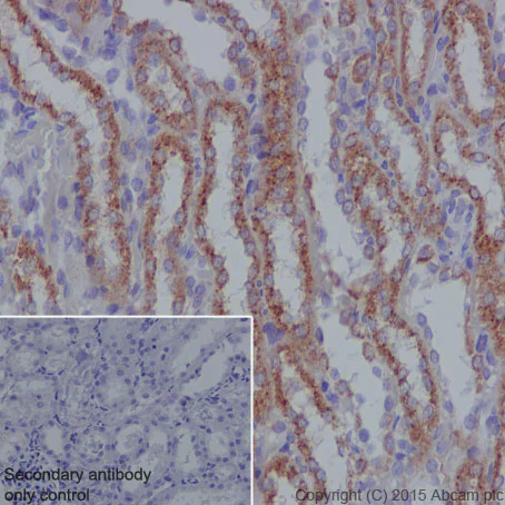 Anti-SDHB antibody [EPR10880] (ab175225) | Abcam