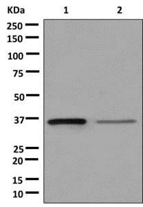 Anti-SDSL antibody [EPR12192] - BSA and Azide free (ab250083) | Abcam
