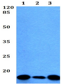 Anti-SEC61B antibody (ab192329) | Abcam
