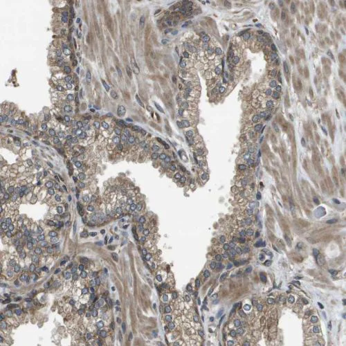 Anti-SEC62 antibody (ab244335) | Abcam