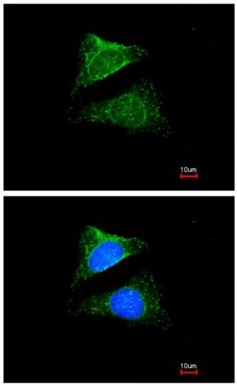 Anti-Seladin 1 antibody (ab137845) | Abcam