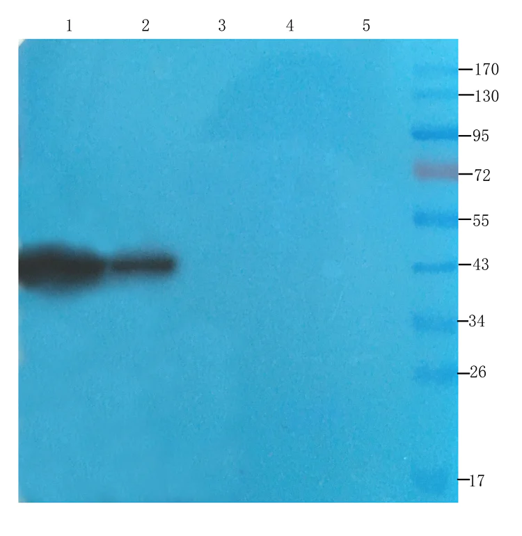 Anti-SEPT5 antibody [SP18] (ab288411) | Abcam
