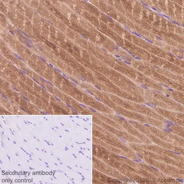 SERCA1 ATPase抗体[IIH11] - BSA and Azide free (ab255961)| Abcam中文官网