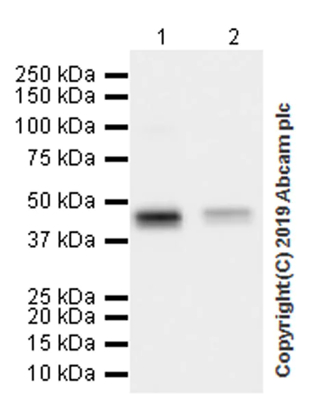 SerpinB3/SCCA + SerpinB4/SCCA-2抗体[EPR22455-57] (ab254255)| Abcam中文官网