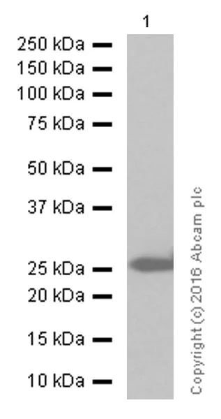 Anti-Serum Amyloid P/SAP antibody [EP1018Y] (ab45151) | Abcam