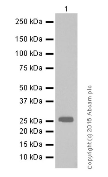 Anti-Serum Amyloid P/SAP antibody [EP1018Y] (ab45151) | Abcam