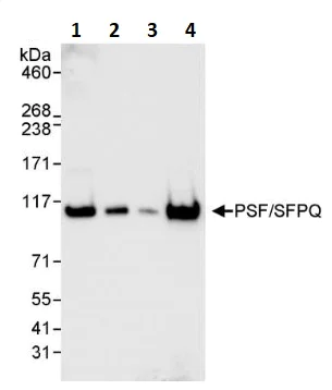 Anti-SFPQ antibody (ab264196) | Abcam