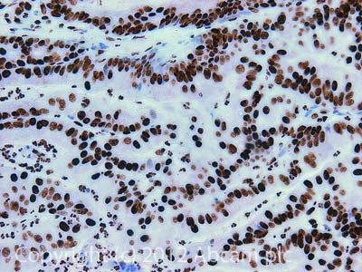 Anti-SFPQ antibody. Rabbit polyclonal (ab38148) | Abcam