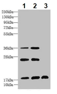 Anti-SFT2D2 antibody (ab236899) | Abcam