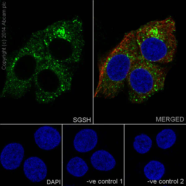 Anti-SGSH/HSS antibody [EPR17312] Rabbit monoclonal (ab200346) | Abcam