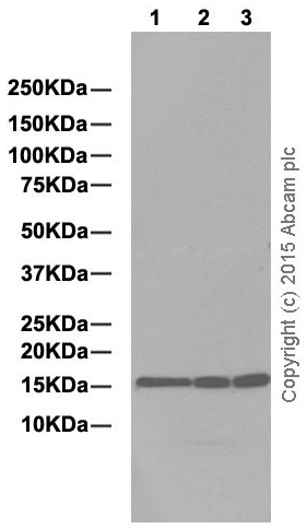 Anti-SH2D1A/SAP antibody [EPR3168] (ab109120) | Abcam