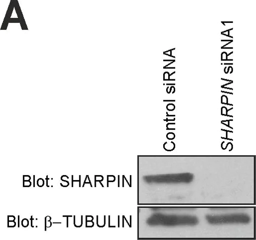 Anti-SHARPIN antibody (ab69507) | Abcam