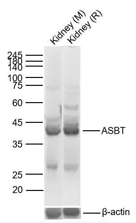 Anti-FXR1 抗体 (ab51970) | Abcam