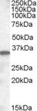 Anti-SLC10A2/ASBT antibody (ab82170) | Abcam
