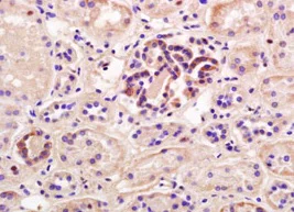 Anti-SLC15A1/PEPT1 antibody (ab203043) | Abcam