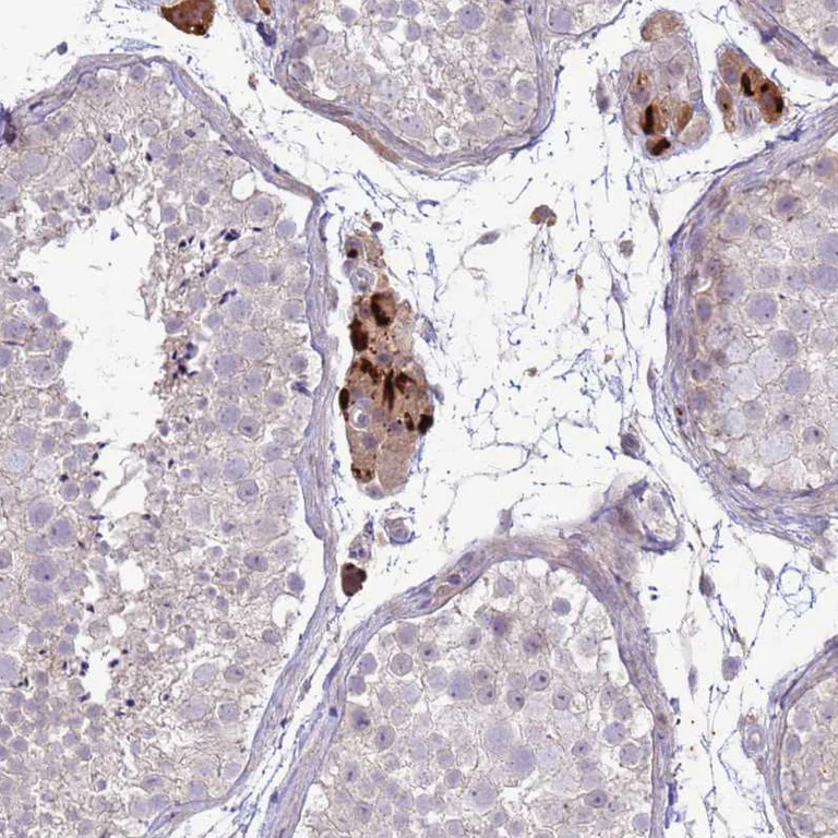 Anti-SLC15A3 antibody (ab254910) | Abcam