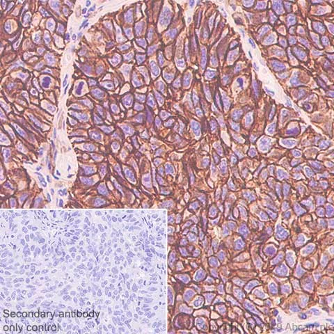 Anti-SLC1A5/ASCT2 antibody [CAL33] (ab237704) | Abcam