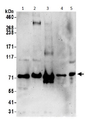 Anti-SLC20A2/PIT2 antibody (ab191182) | Abcam