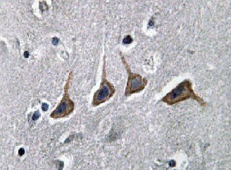 Anti-SLC22A6 antibody (ab135924) | Abcam