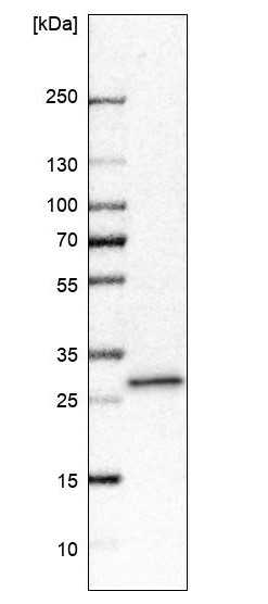Anti-SLC25A20 antibody (ab244436) | Abcam