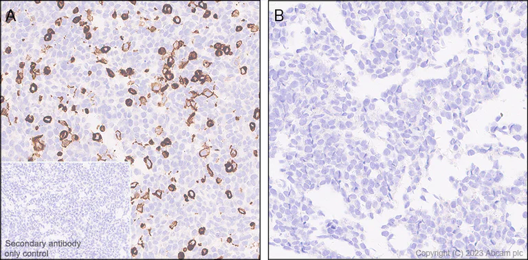 Anti-SLC26A2/DTD antibody [EPR27119-34] (ab308627) | Abcam