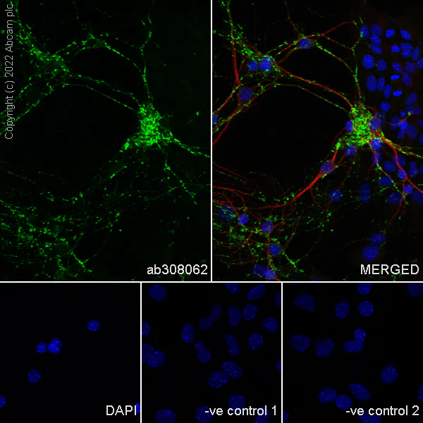 Anti-SLC32A1/VGAT antibody [EPR26258-9] (ab308062) | Abcam