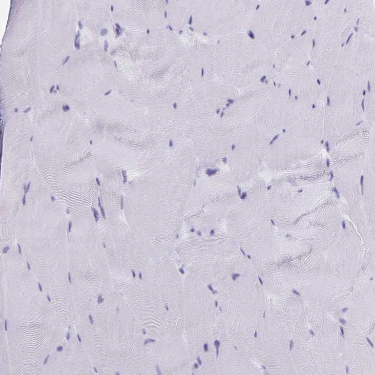 Anti-SLC34A2 antibody (ab122431) | Abcam
