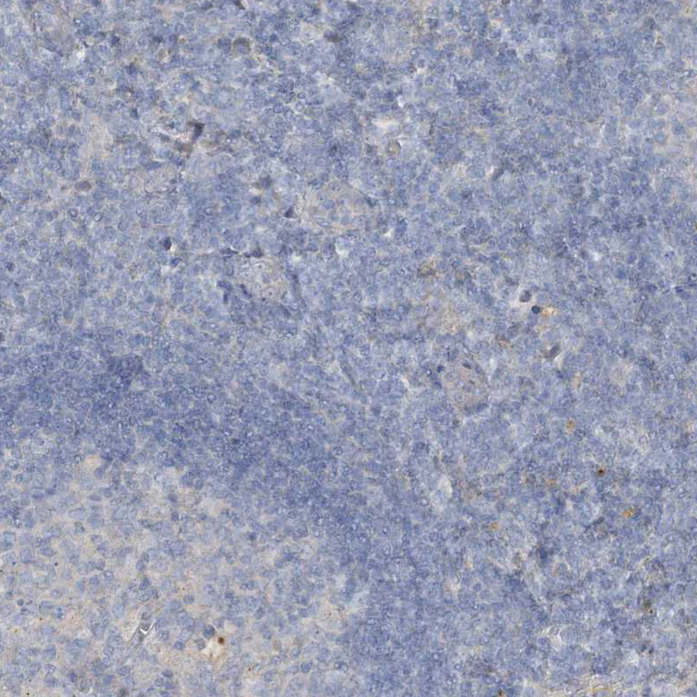 Anti-SLC4A10 antibody (ab122229) | Abcam