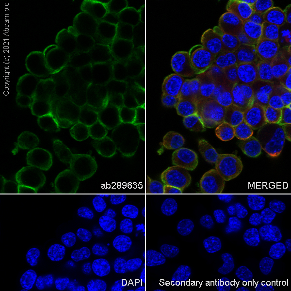 Anti-SLC5A7 antibody [EPR25152-16] (ab289635) | Abcam