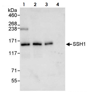 Anti-Slingshot homolog 1/SSH1 antibody (ab76943) | Abcam