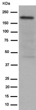 Anti-Slit1 + Slit2 antibody [EP5796(N)] (ab183704) | Abcam