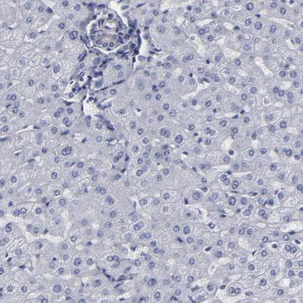 Anti-SLMAP antibody (ab243383) | Abcam