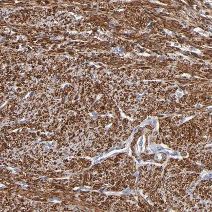 Anti-SLMAP antibody (ab243383) | Abcam