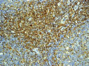 Anti-SLP76 antibody [EPR2549(2)] - BSA and Azide free (ab247808) | Abcam