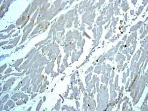 Anti-SLP76 antibody [EPR2549(2)] - BSA and Azide free (ab247808) | Abcam