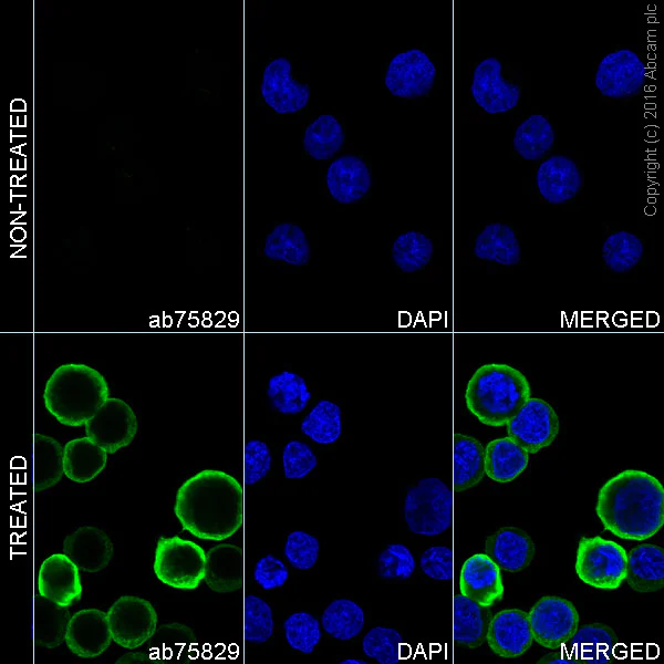 Anti-SLP76 (phospho Y145) antibody [EP2853Y] (ab75829) | Abcam