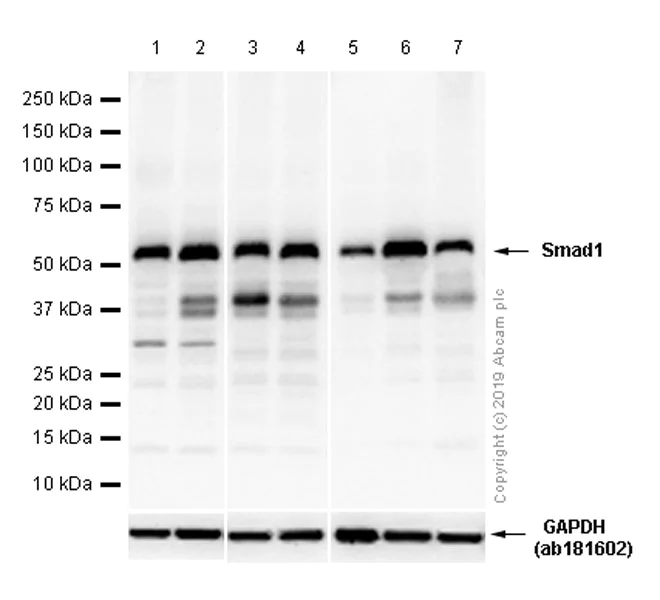 Anti-Smad1 antibody [EP565Y] - BSA and Azide free (ab172642) | Abcam