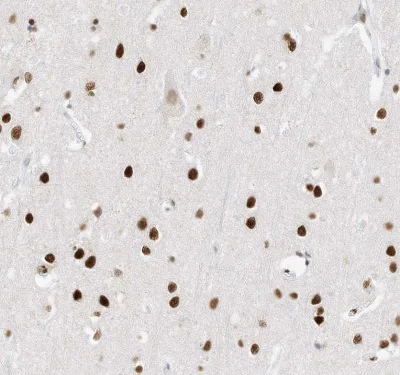 Anti-SMARCA2 / BRM antibody (ab223735) | Abcam