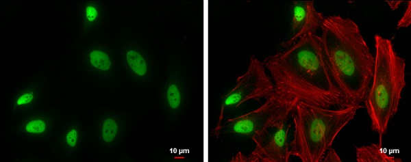 Anti-SMARCA2 / BRM antibody (ab227000) | Abcam