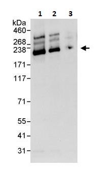 Anti-SMARCA2 / BRM antibody (ab264163) | Abcam