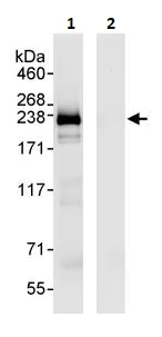Anti-SMARCA2 / BRM antibody (ab264164) | Abcam