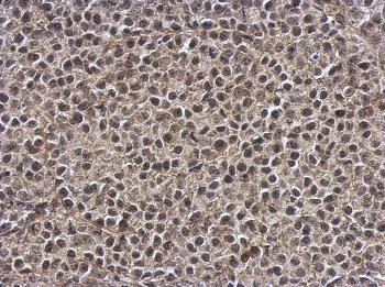 Anti-SMG7 antibody (ab126984) | Abcam